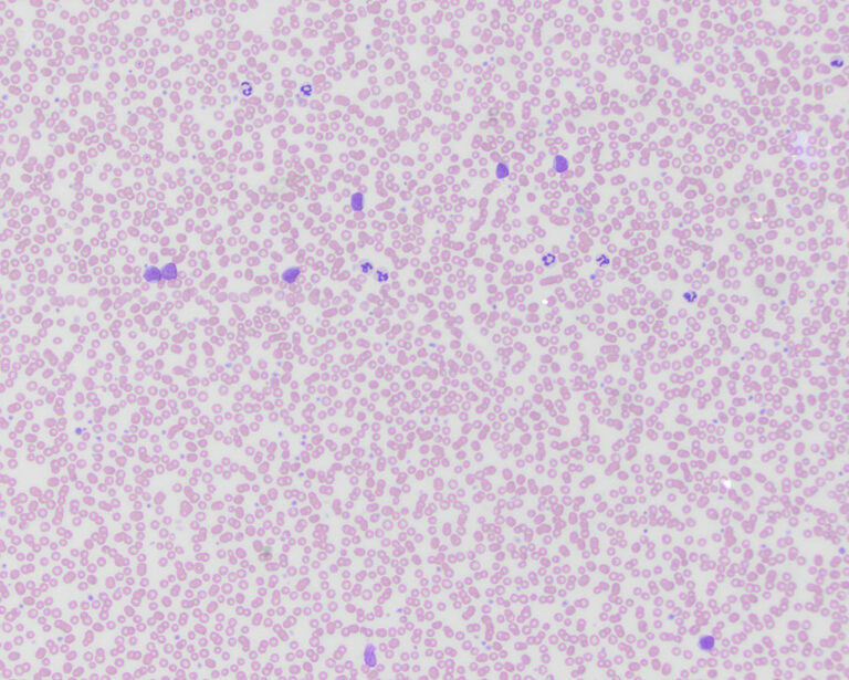 Figure 1: Representative image of a blood smear from a dog with ...