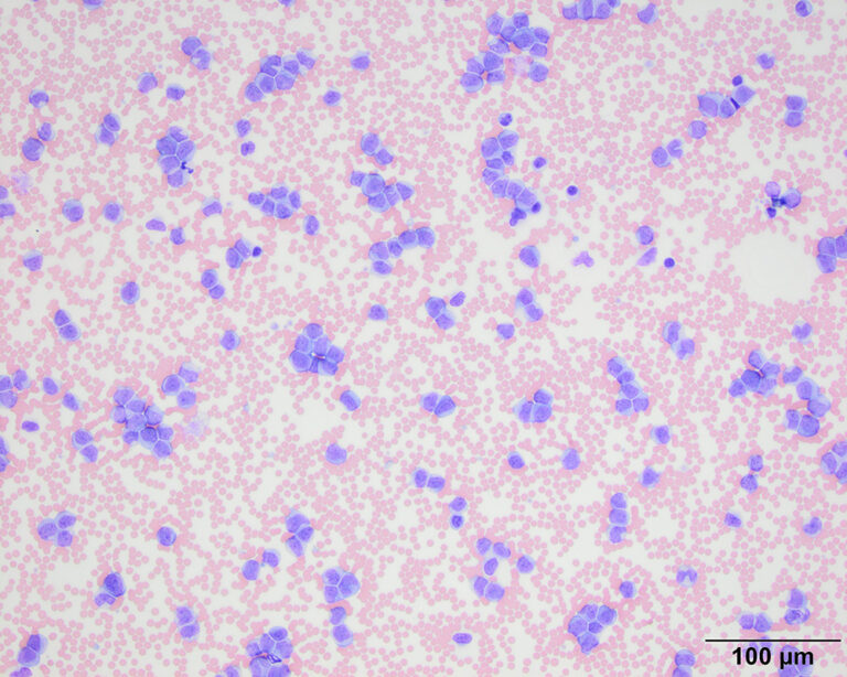 Figure 1: Venous blood from a cat with a marked leukocytosis | eClinpath