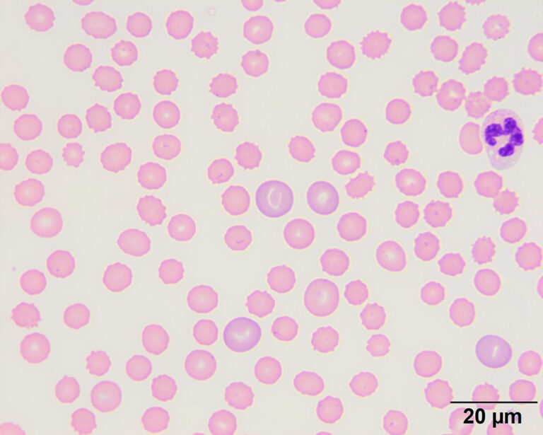 Figure 2: Blood smear from a dog with reduced appetite | eClinpath