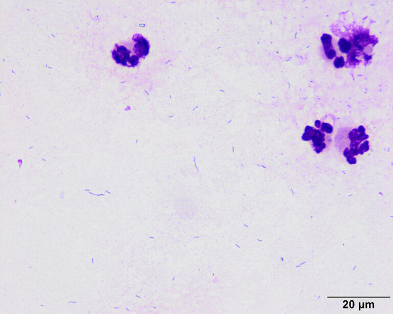 Figure 2: Aspirate of a cystic hepatic mass in a dog | eClinpath