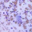 Figure 1b: Mixed inflammatory cells | eClinpath
