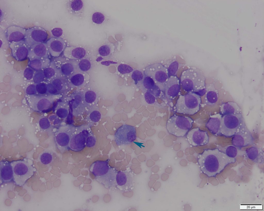 Figure 2: Impression smear from a penile mass in a dog. Wright's stain ...
