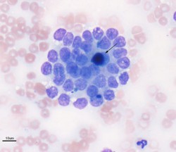 Figure 2a: Epithelial cells forming distinct acini | eClinpath