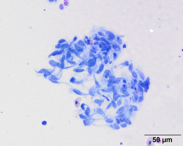 Figure 4: Aspirate of a peri-orbital mass in a bearded dragon | eClinpath