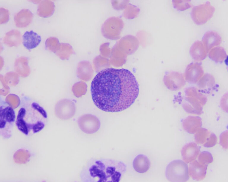 Figure 2: Venous blood from a Hedgehog | eClinpath