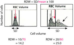 The concept of the red blood cell distribution width (RDW) | eClinpath