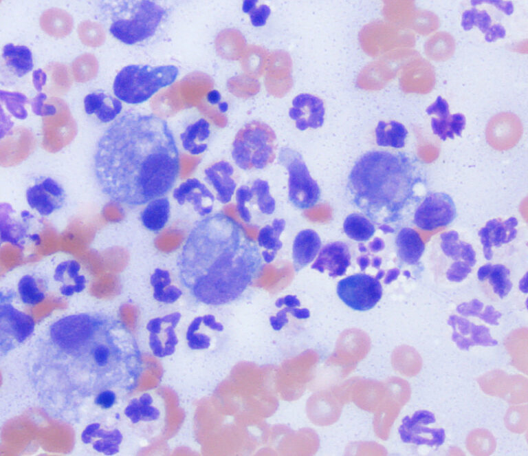 Mixed inflammation | eClinpath